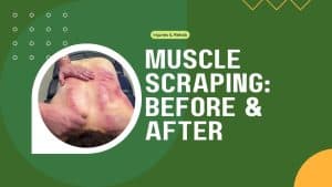 Muscle Scraping Before and After Results | A1 Athlete